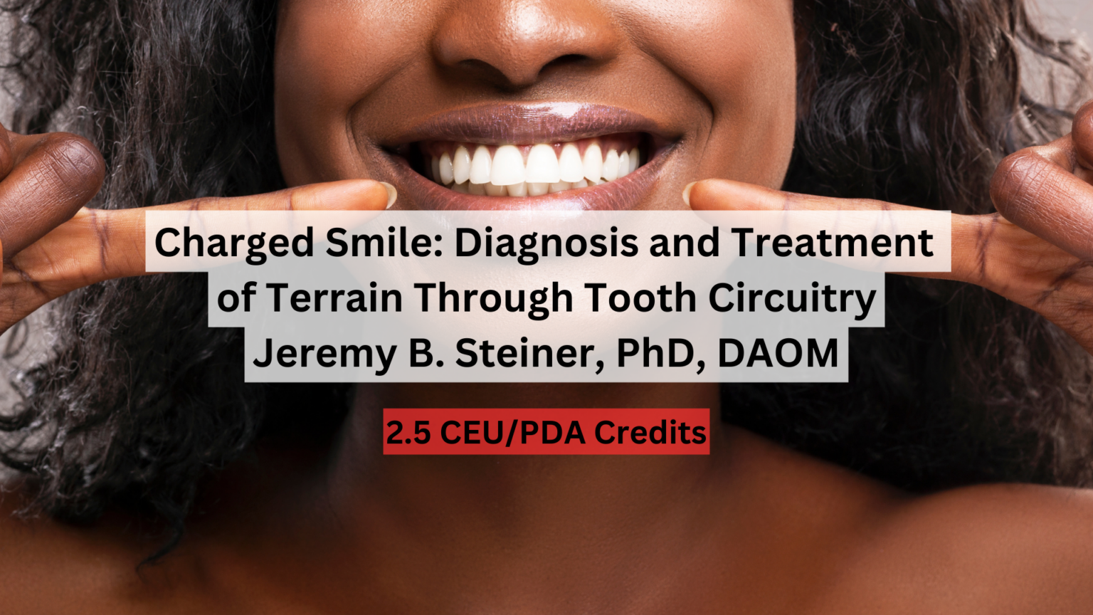 Charged Smile: Diagnosis and Treatment of Terrain Through Tooth ...